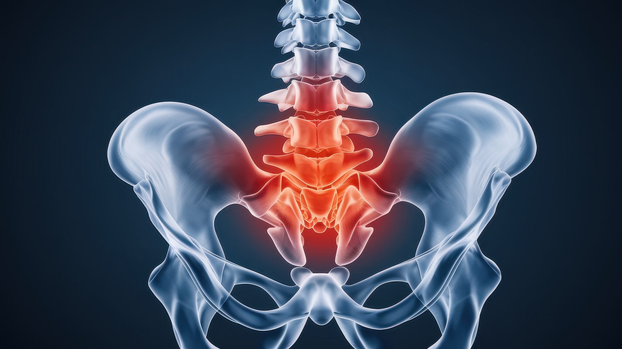 Buffalo Spine & Sports Medicine - Buffalo, NY - iFuse INTRA X ...